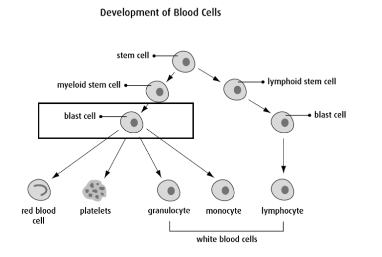 Acute Myeloid Leukemia (AML) - Leukemia / Bone Marrow Transplant Program