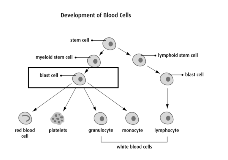 Myelodysplastic Syndromes (MDS) - Leukemia / Bone Marrow Transplant Program